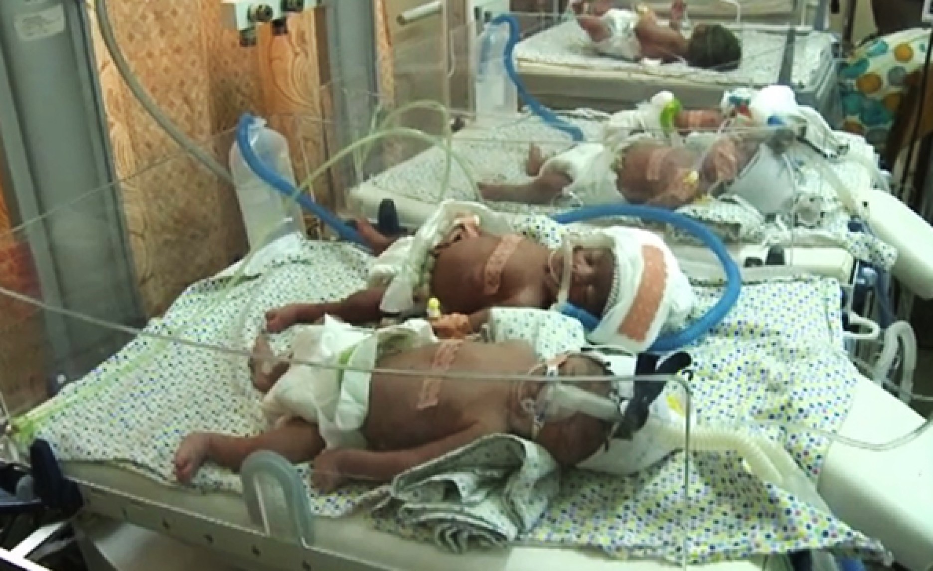 Rwanda: Mother Gives Birth to Four Babies At Muhima Hospital ...